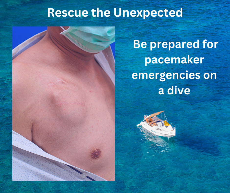 Rescue Diver: What to Do When Your Victim Has a Pacemaker – Malibudivers